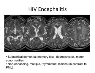 Ring Enhancing Lesion in HIV Positive Patient | PPT