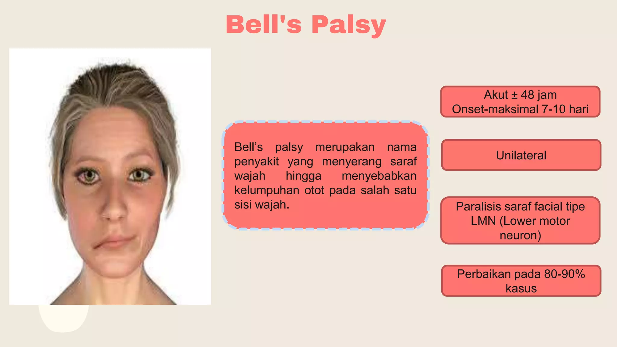 Bell's Palsy | PPTX