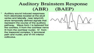 ABR testing | PPT