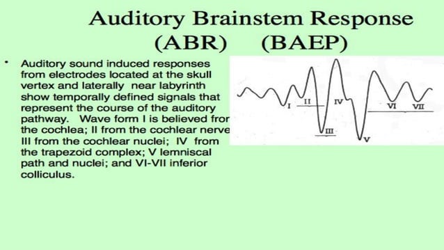 ABR testing | PPT