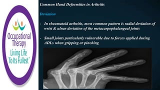 Occupational Therapy and Rheumatoid Arthritis | PPTX