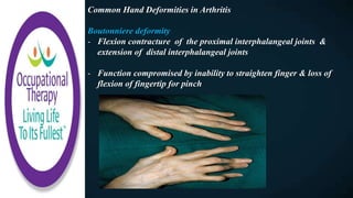 Occupational Therapy and Rheumatoid Arthritis | PPTX