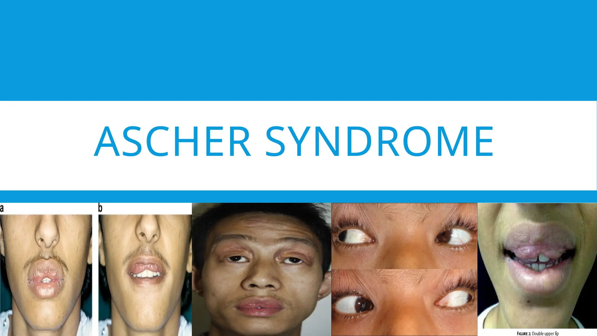 042 oral patjlofy asvher sybchg jugv.pptx