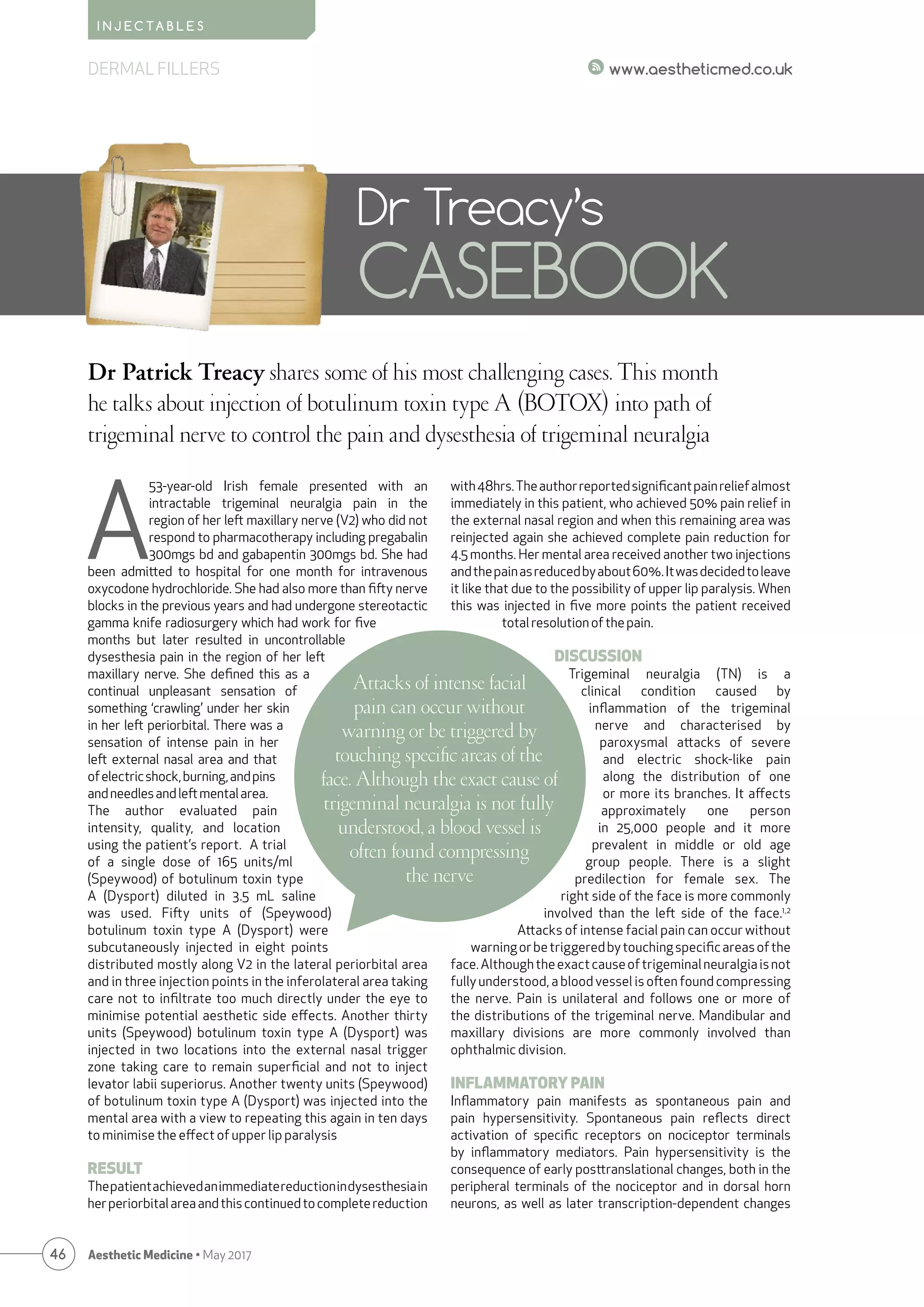 Using Botox for trigeminal neuralgia | PDF