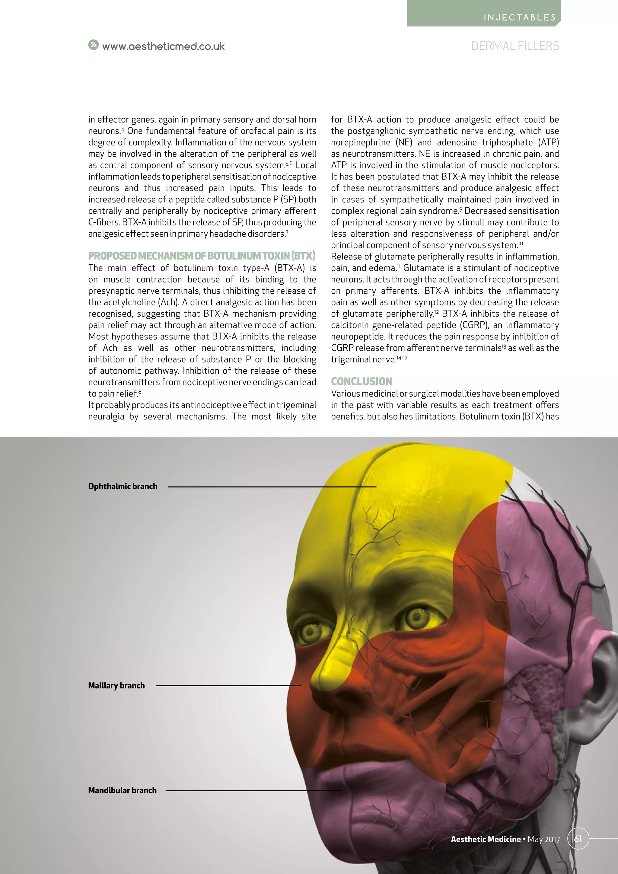 Using Botox for trigeminal neuralgia | PDF