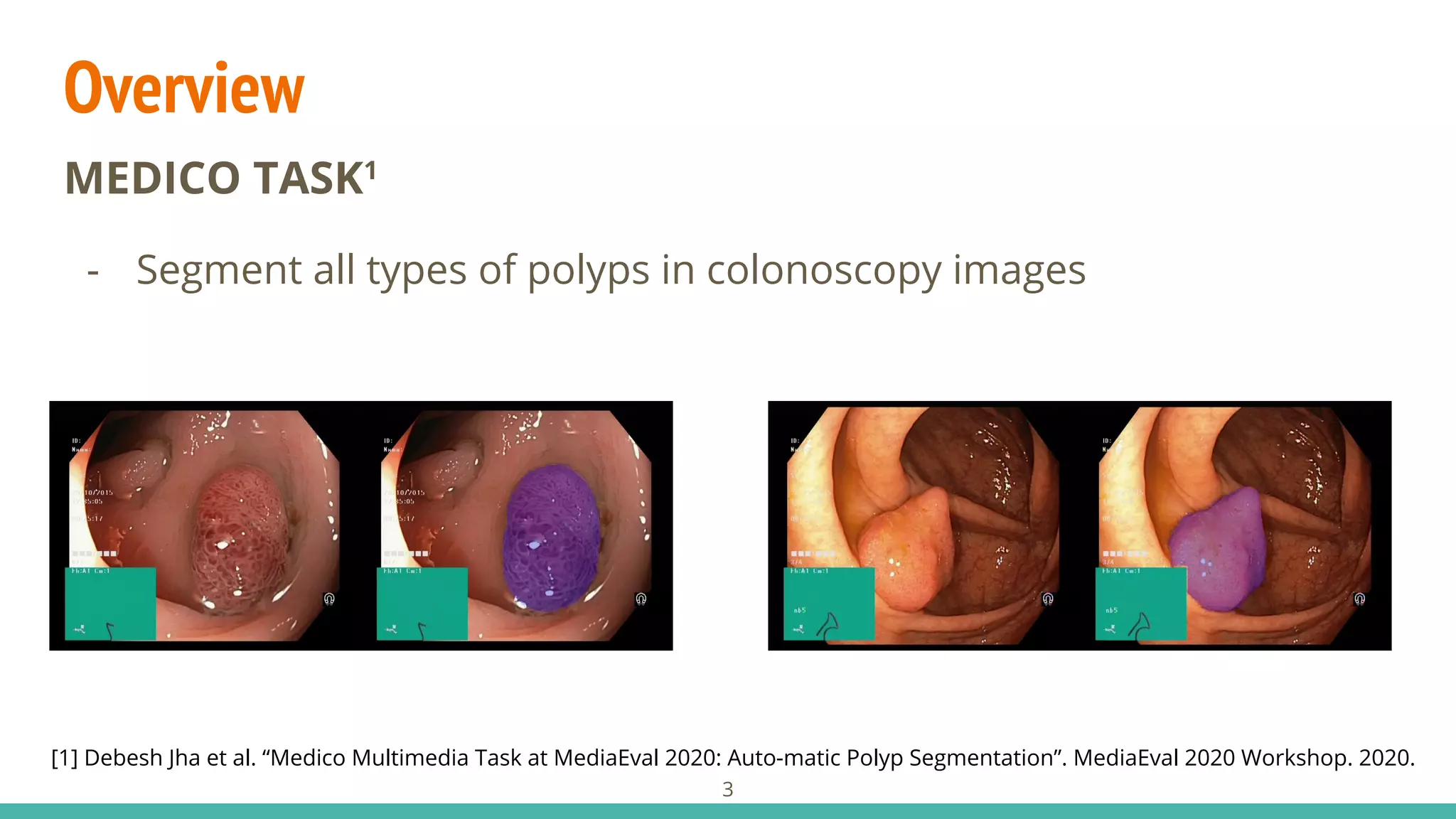 Hcmus At Medico Automatic Polyp Segmentation Task 2020 Pranet And Resunet For Polyps
