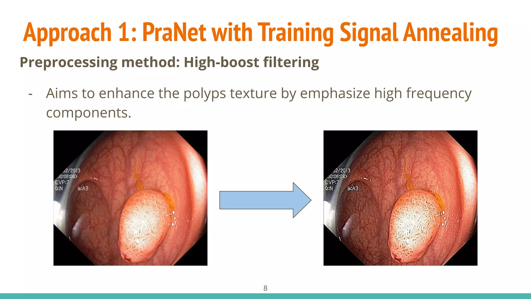 Hcmus At Medico Automatic Polyp Segmentation Task 2020 Pranet And Resunet For Polyps