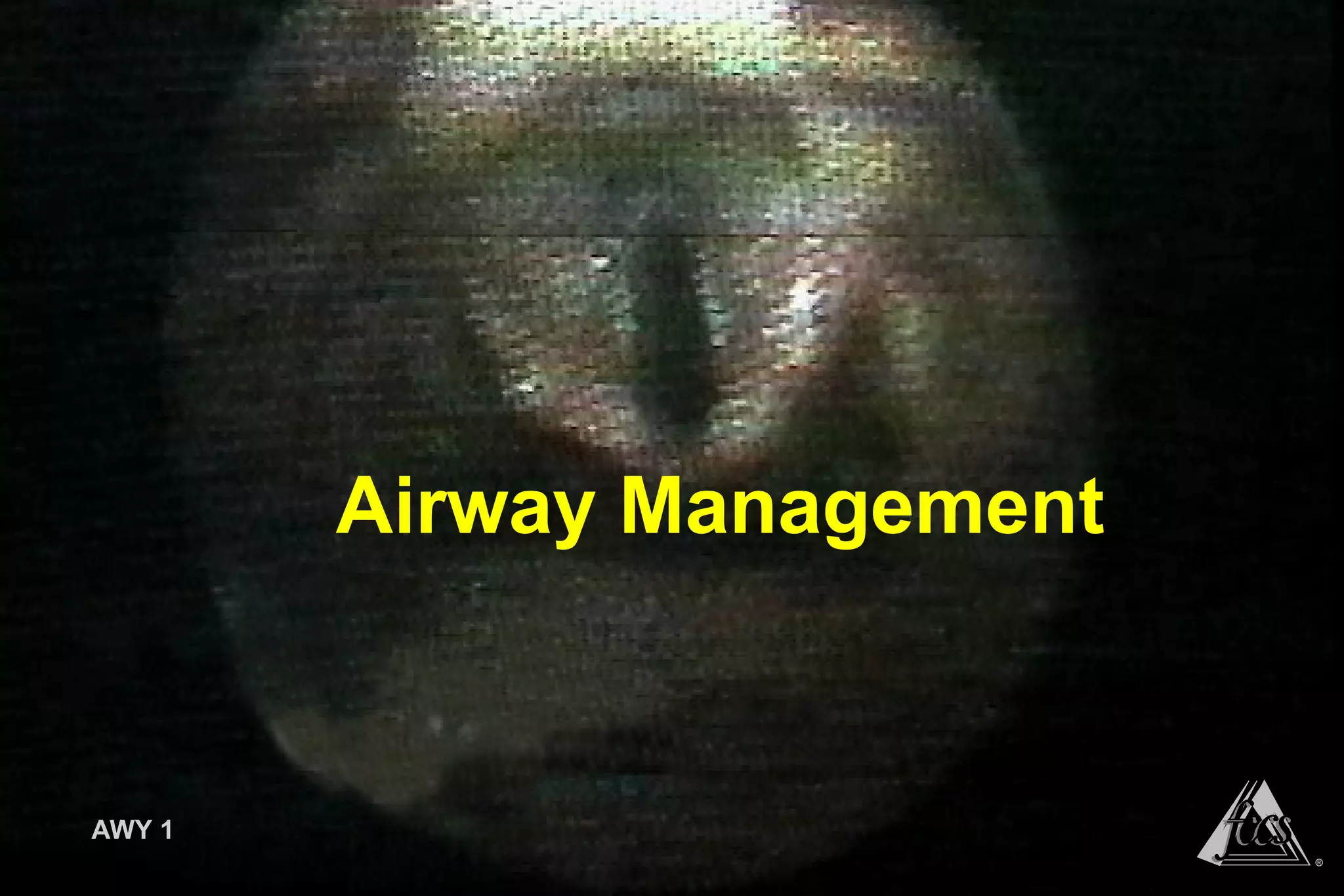 Airway management | PPT