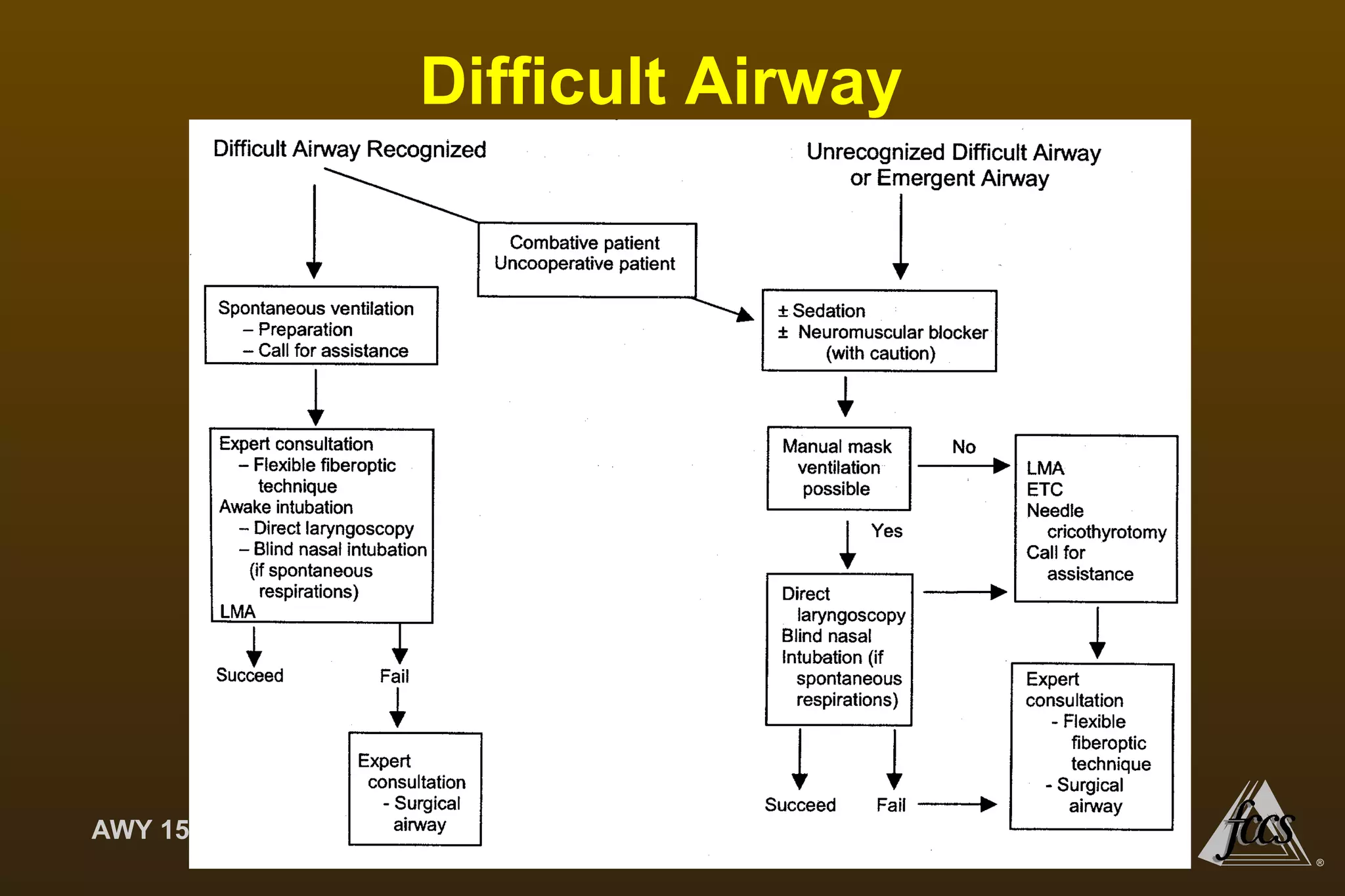 Airway management | PPT