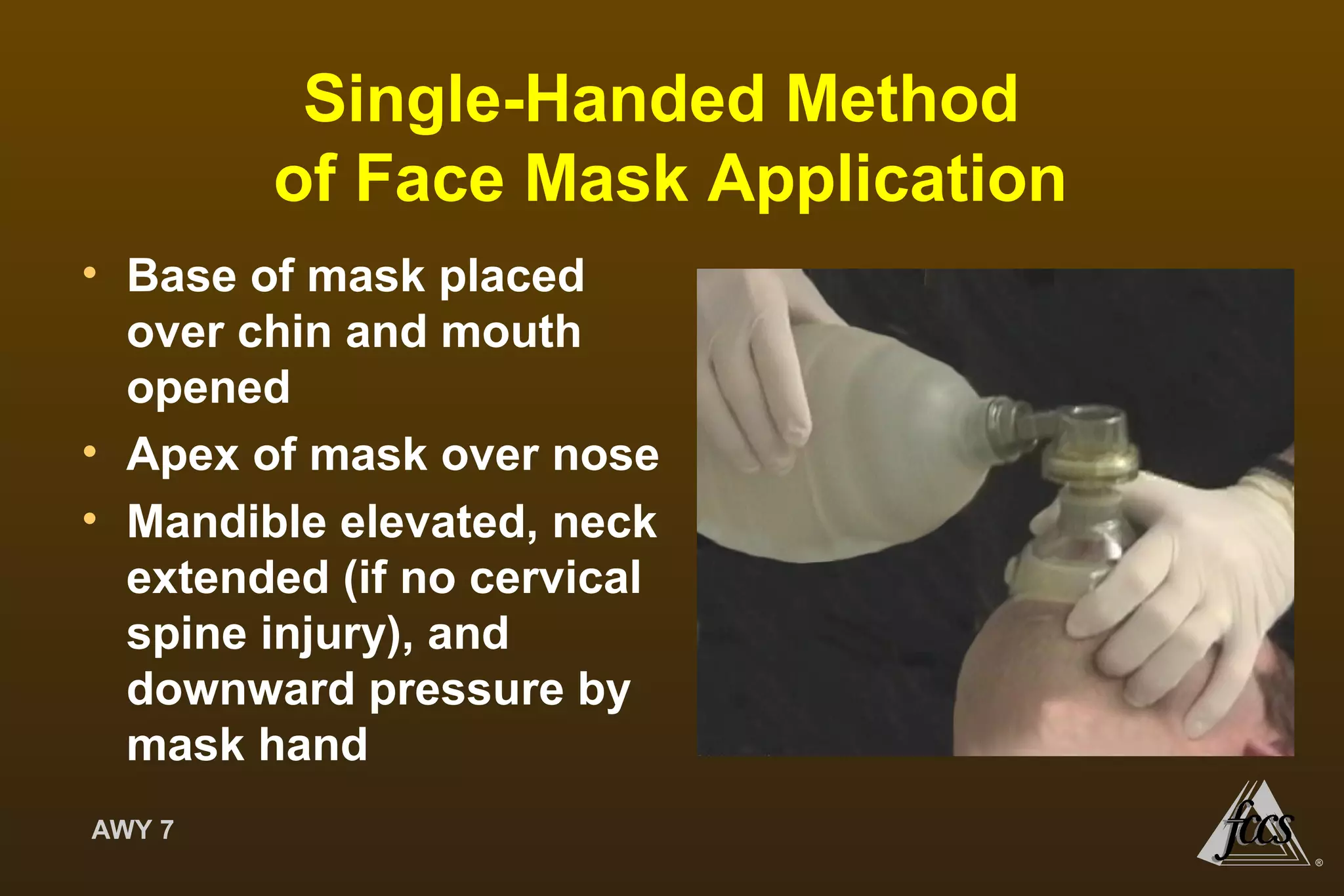 Airway management | PPT