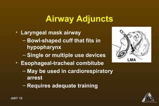Airway management | PPT