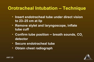 Airway management | PPT