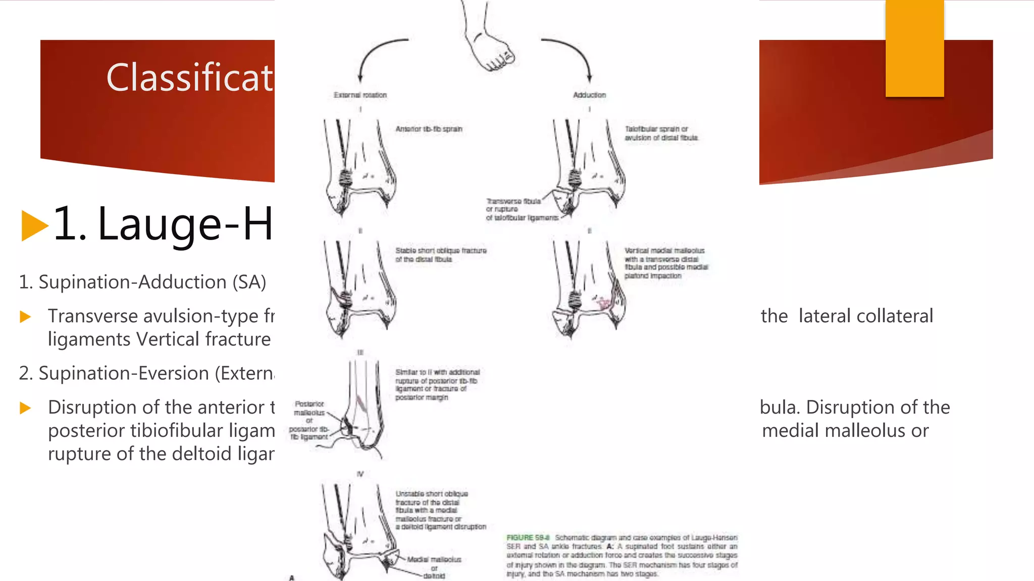04 ankle fractures ppt | PPTX