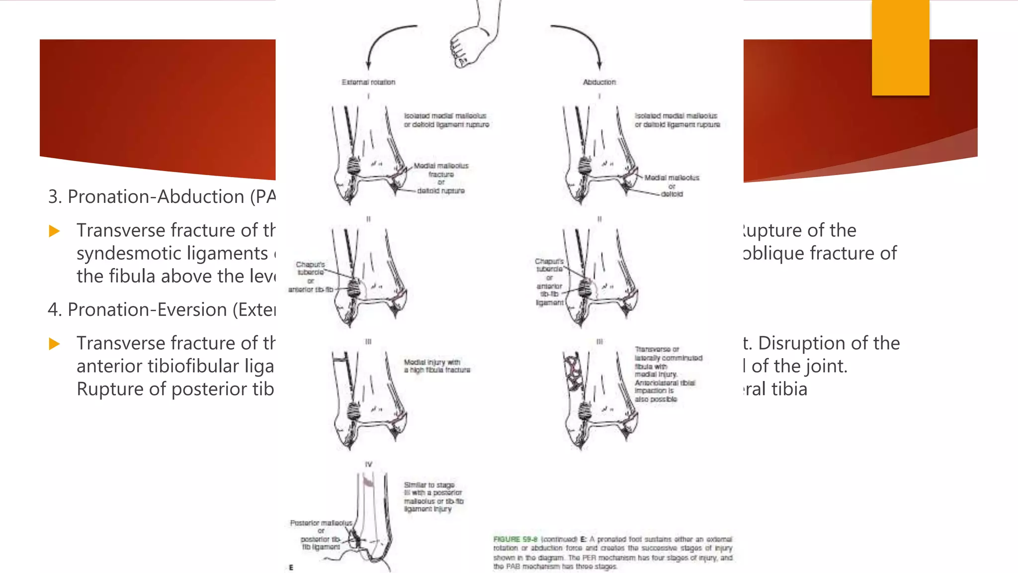 04 ankle fractures ppt | PPTX