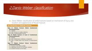 04 ankle fractures ppt | PPTX