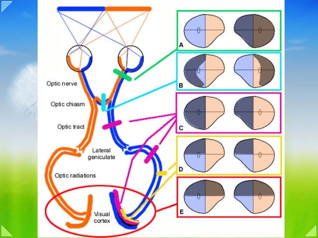 04a visiual signal processing intorduction | PDF | Eye and Vision ...