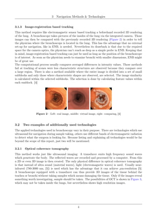 IGS_final_report_bronchoscopy | PDF