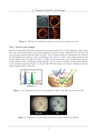 IGS_final_report_bronchoscopy | PDF