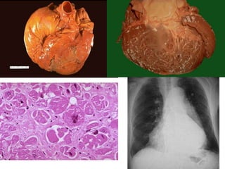 04 cardiac pathology | PPT
