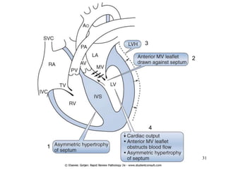 04 cardiac pathology | PPT