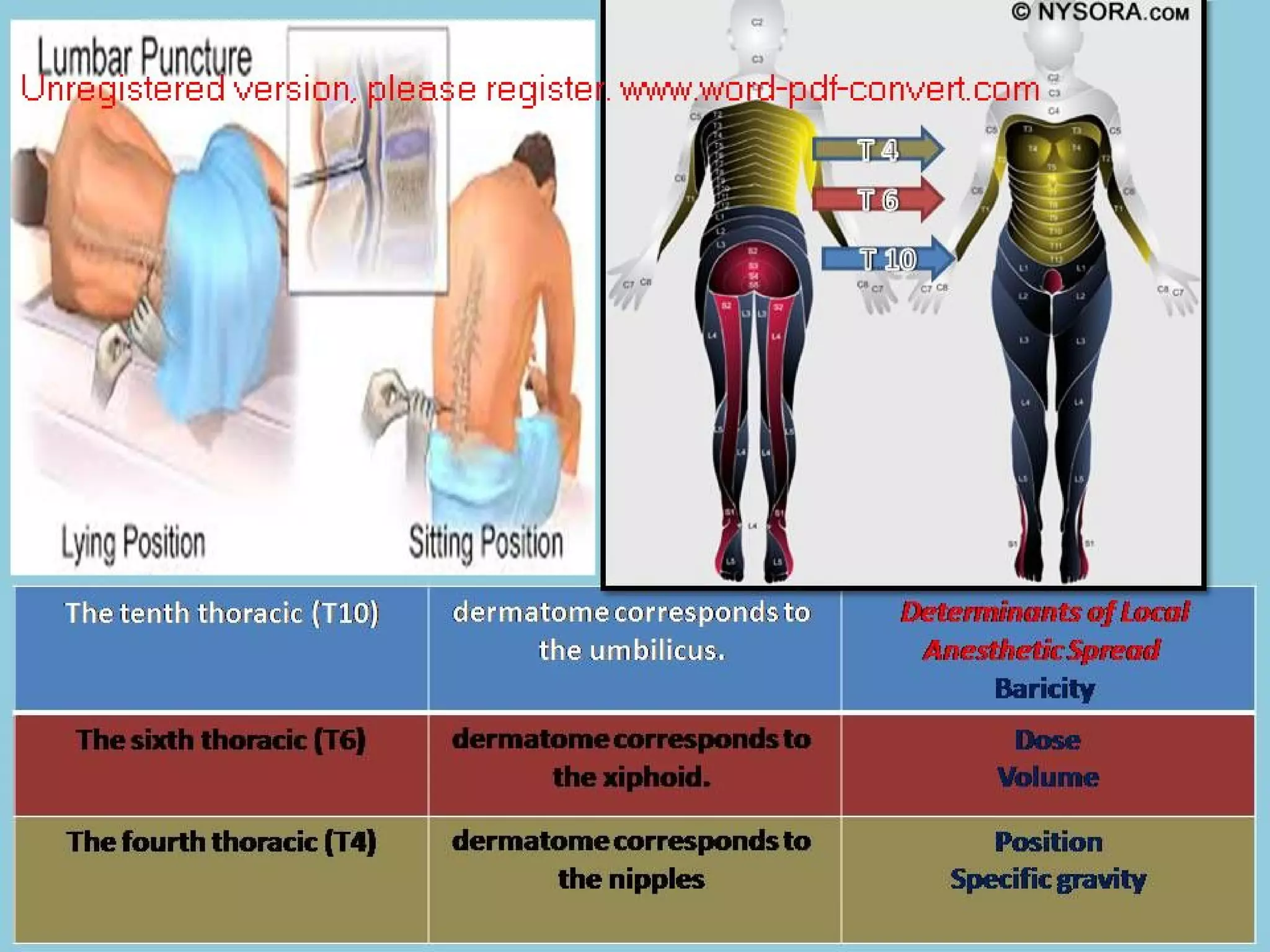 File2-High Spinal Anesthesia for cardiac high Risk with spinal ...