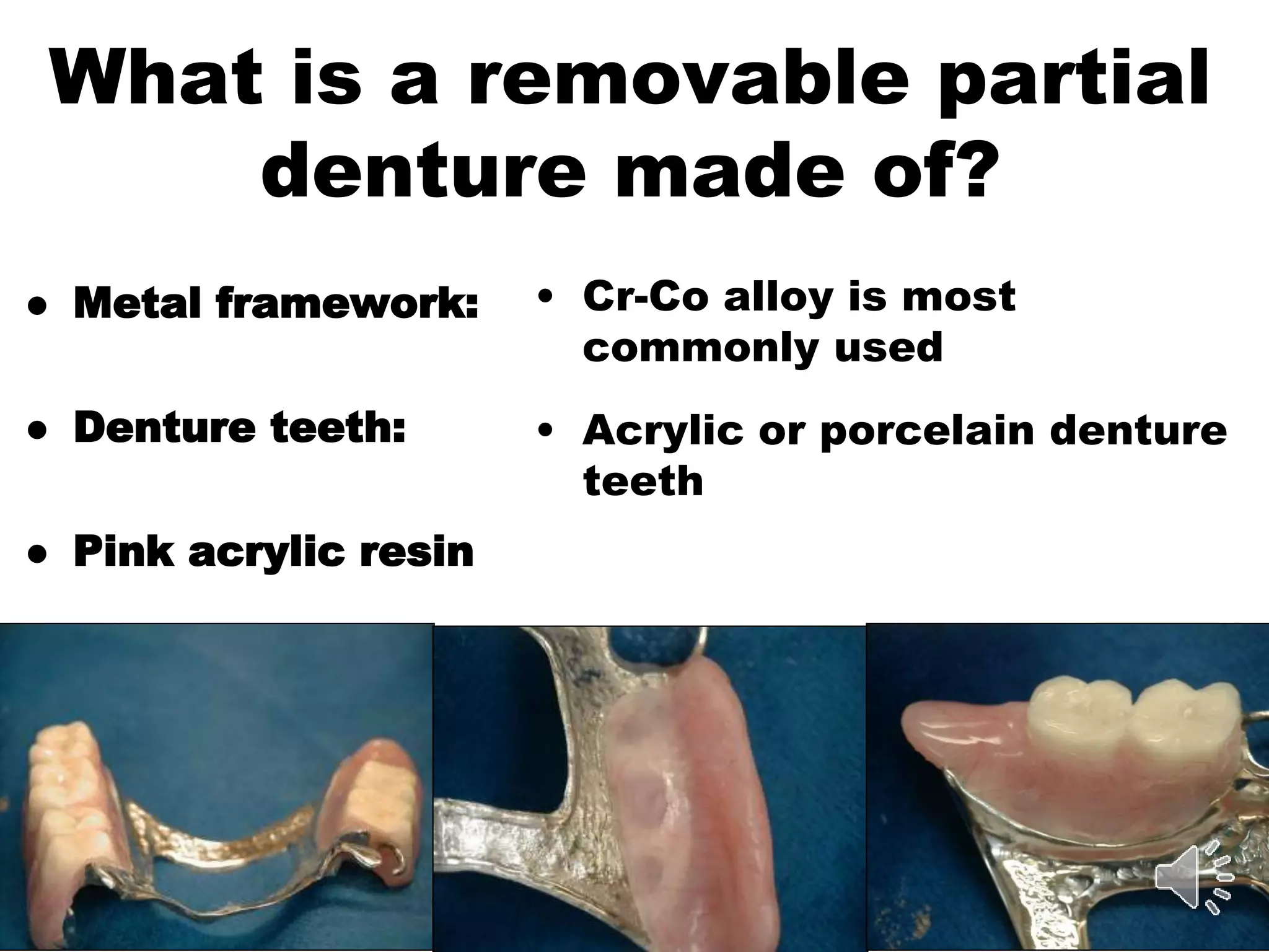 Denture bases of RPDs | PPT
