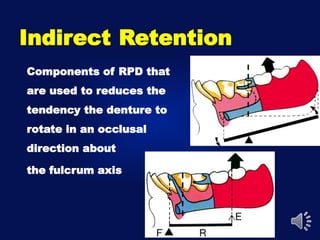 Denture bases of RPDs | PPT