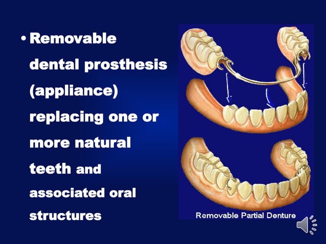 Denture bases of RPDs | PPT