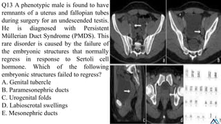 04 Development of Male Reproductive System.pdf