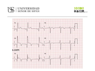04 EKG - ejercicios.pdf