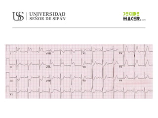 04 EKG - ejercicios.pdf