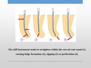 Endodontics. anatomy of root canals. instruments | PPT