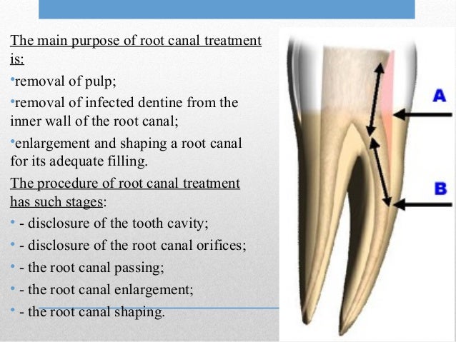 Endodontics. anatomy of root canals. instruments