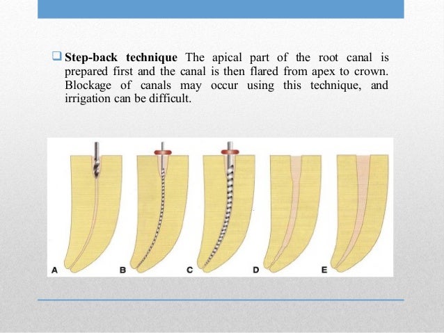Endodontics. anatomy of root canals. instruments