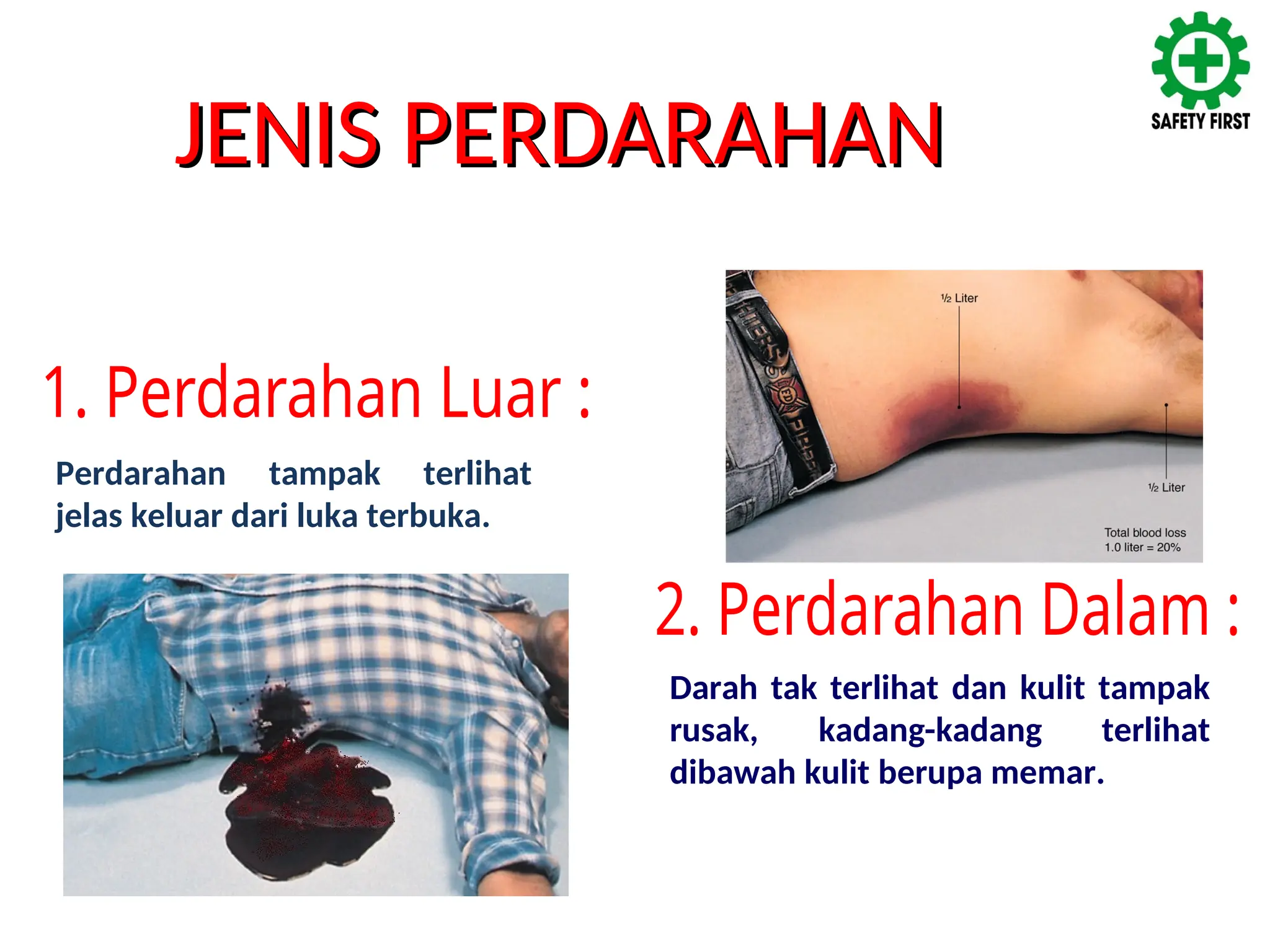 Pertolongan pertama pada kecelakaan tentang perdarahan | PPT