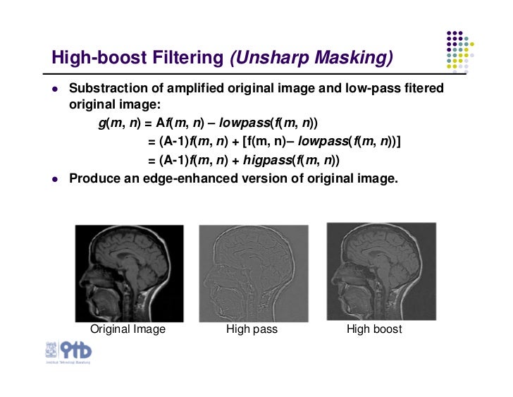 04 Image Enhancement Edge Detection