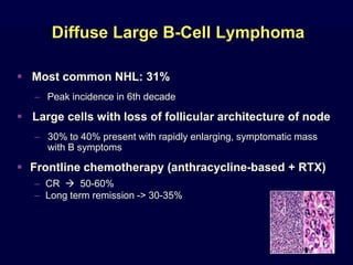 Hematopoietic Stem Cell Transplantation: High Risk Diffuse Large Cell ...