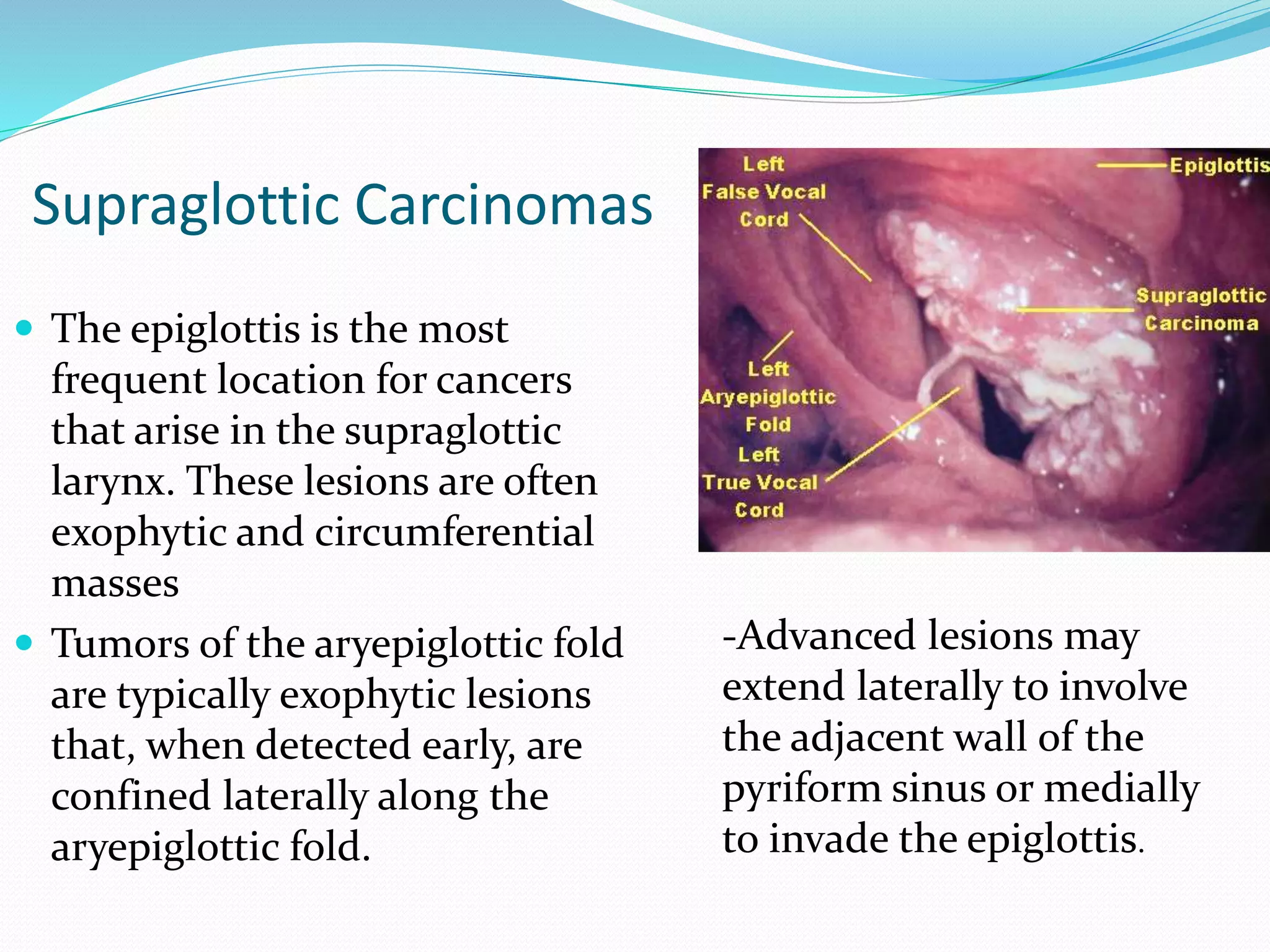 Carcinoma anatomy and epidemiology | PPTX