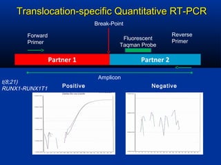 Monitoring of Minimal Residual Disease Principles and Applications | PPT