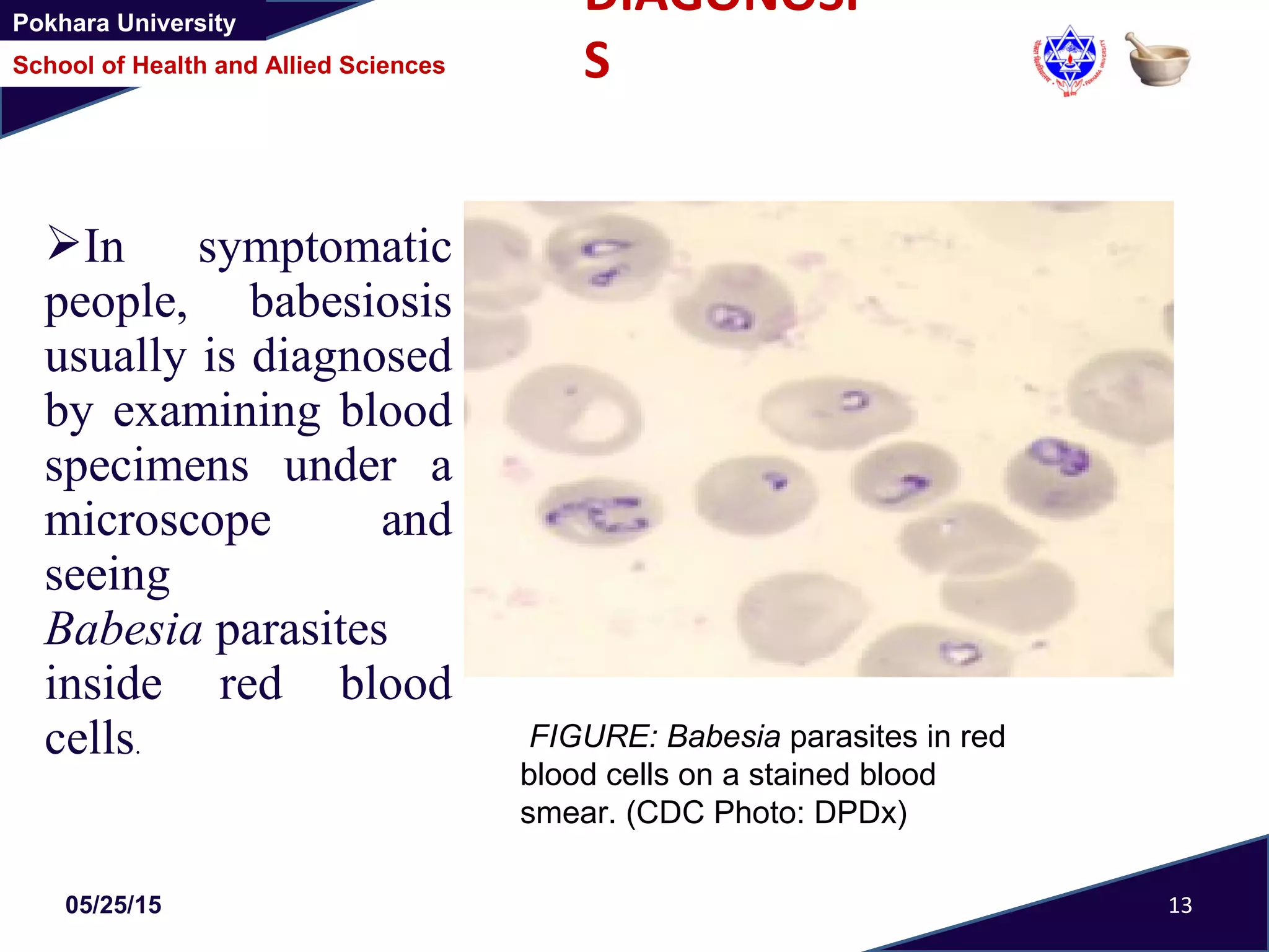 04 narayan babesiosis | PPT