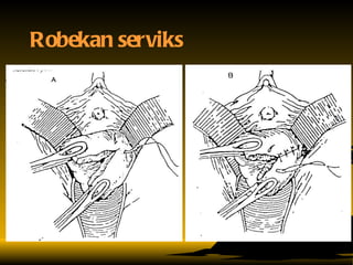 04 perdarahan pasca persalinan | PPT