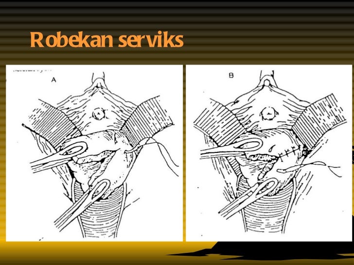 04 perdarahan pasca persalinan