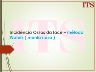 04 POSICIONAMENTOS DOS OSSOS DA FACE.pdf