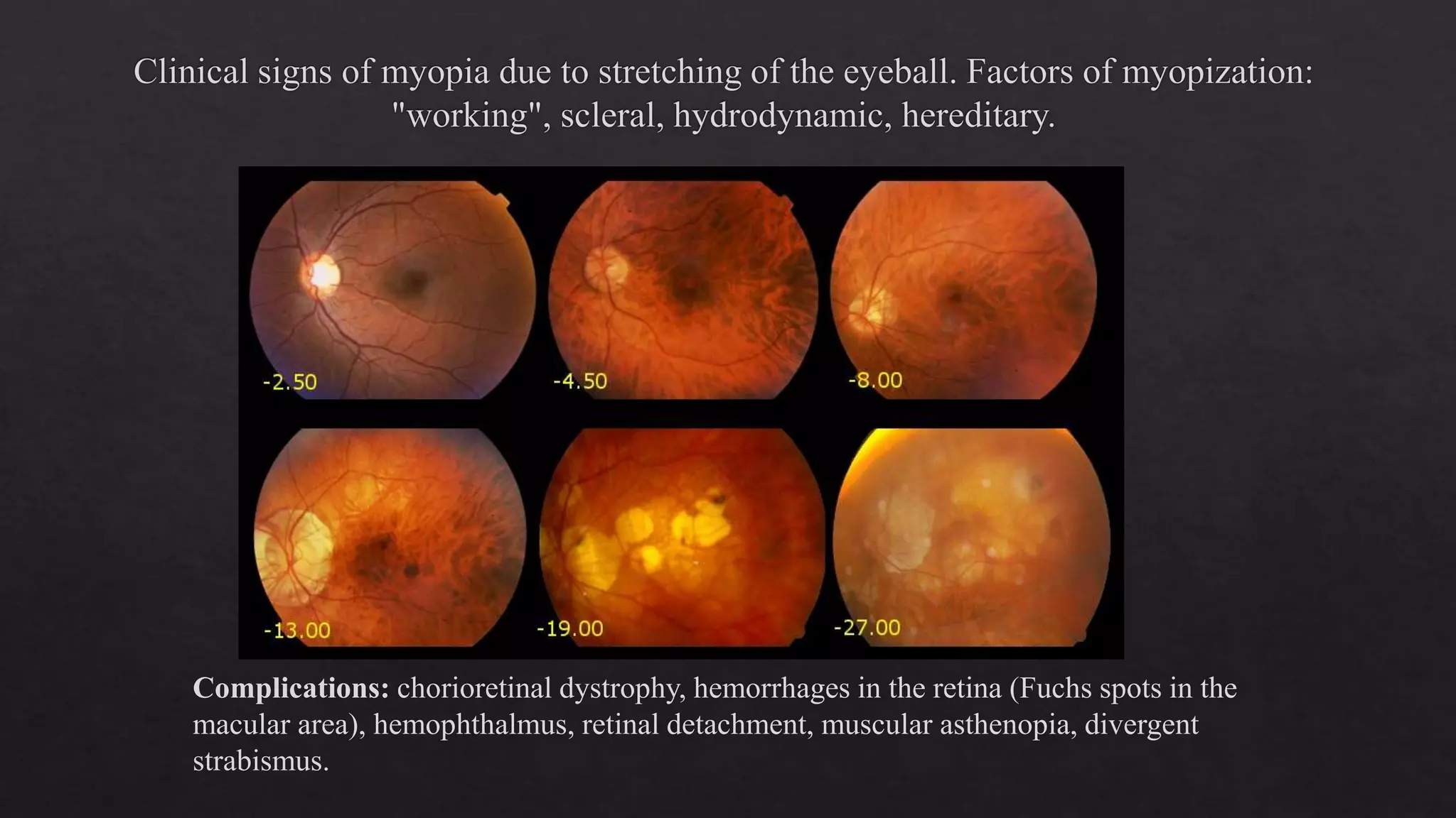 Opthalmology Refraction and Accommodation.pptx