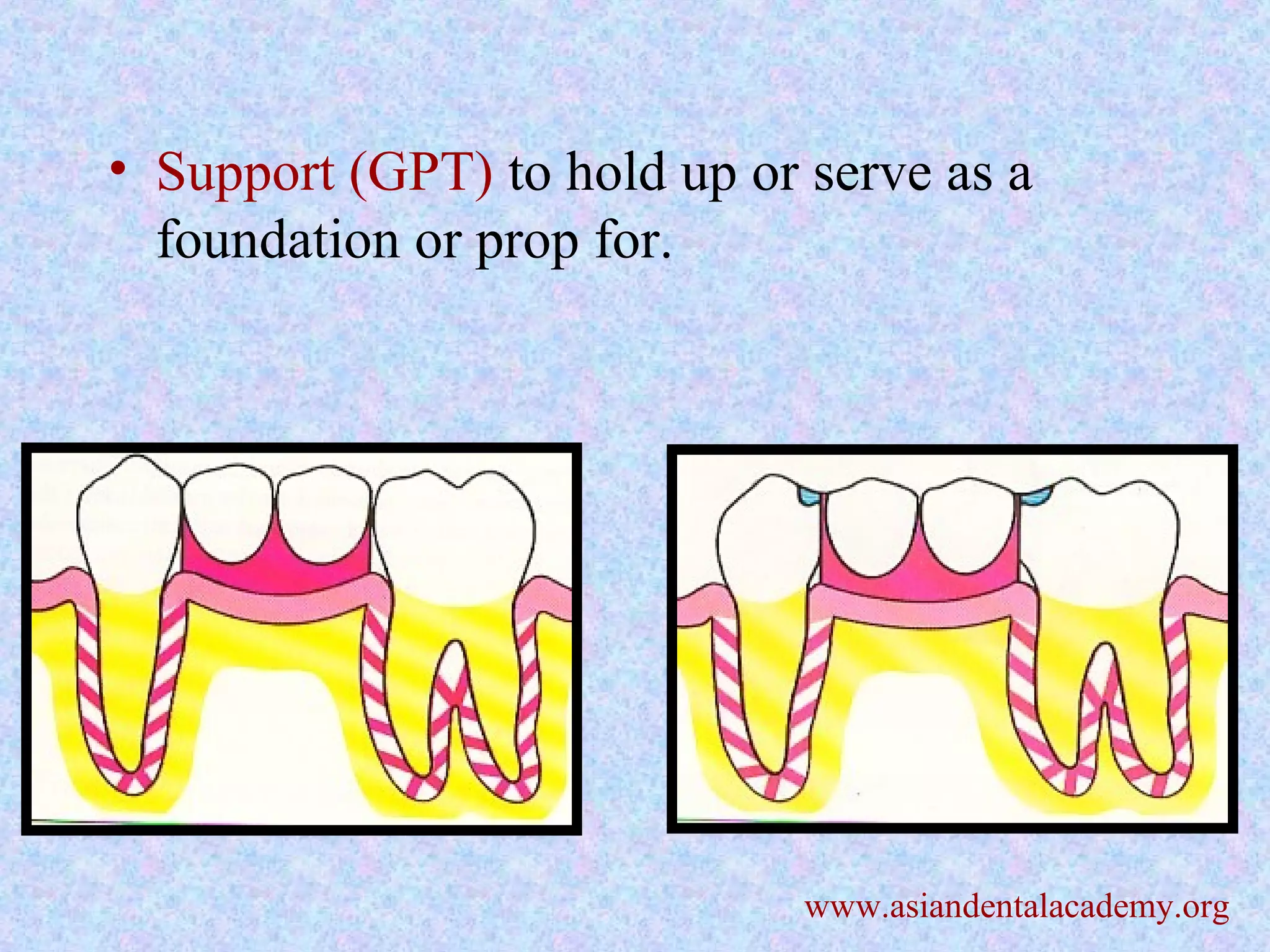 Rests & Rest seats in removable partial Dentures | PPT