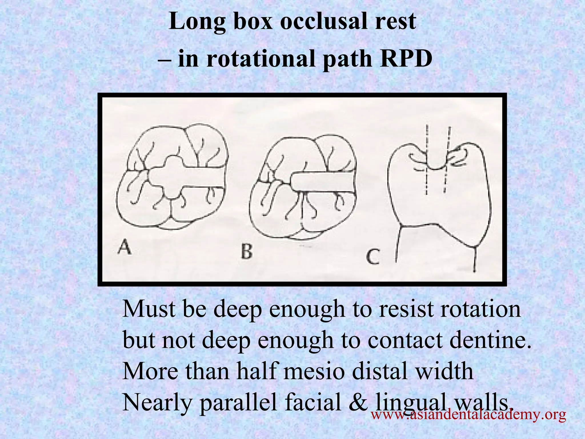 Rests & Rest seats in removable partial Dentures | PPT