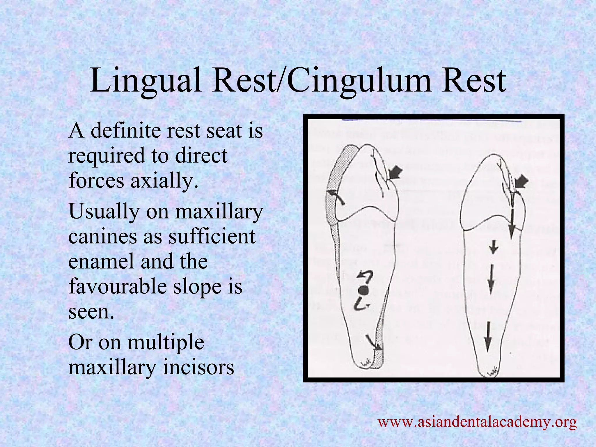 Rests & Rest seats in removable partial Dentures | PPT