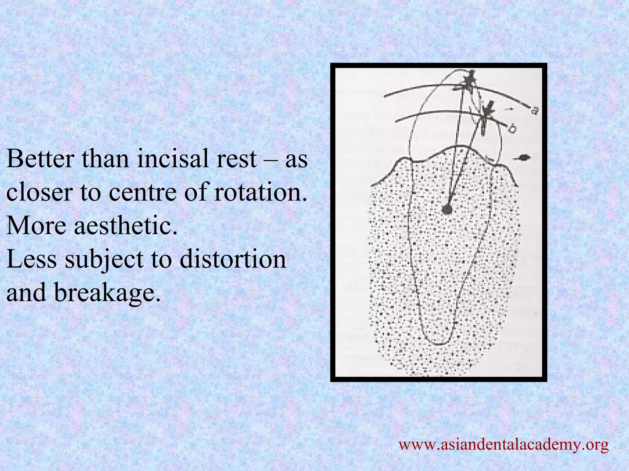 Rests & Rest seats in removable partial Dentures | PPT