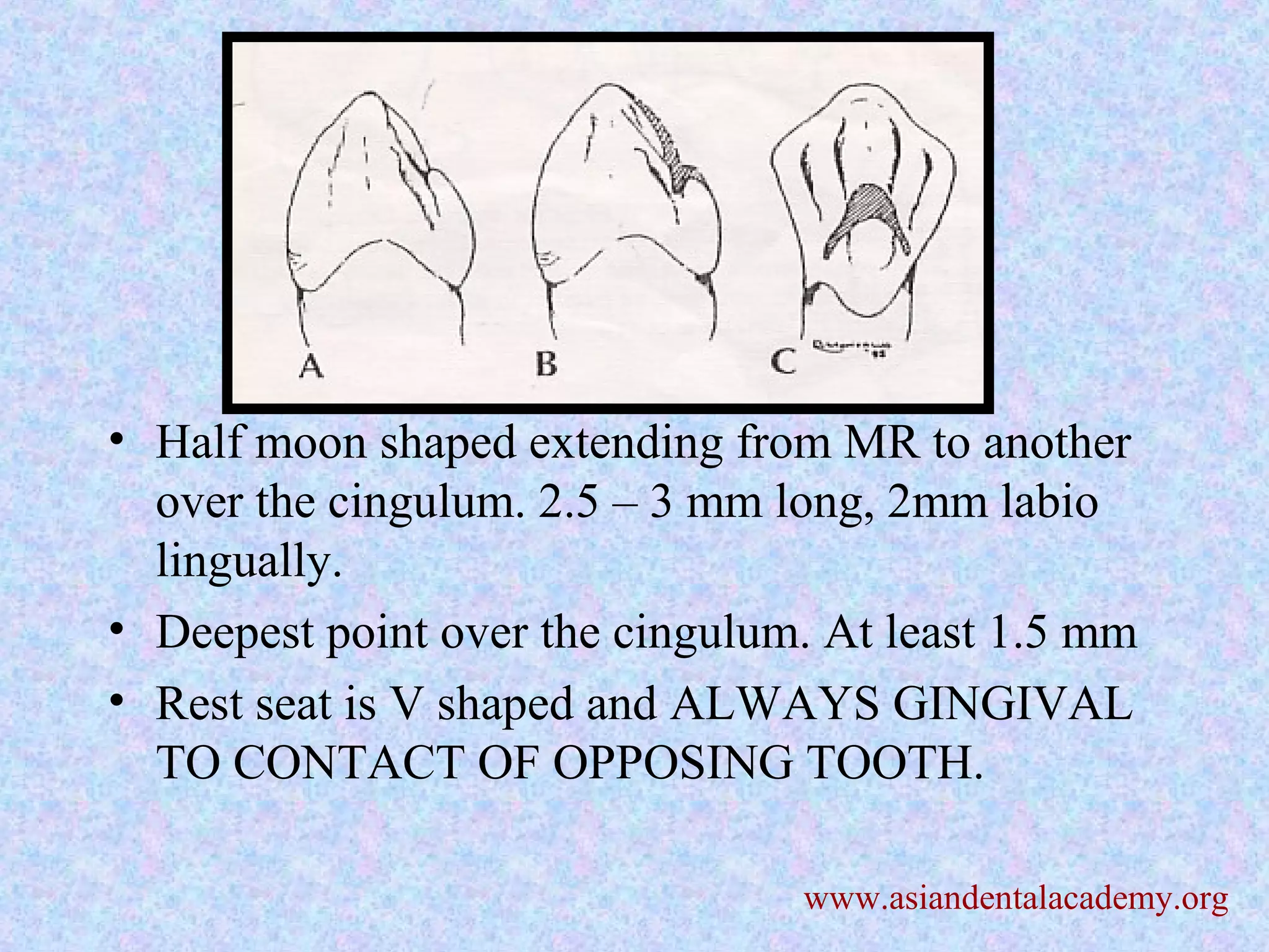 Rests & Rest seats in removable partial Dentures | PPT