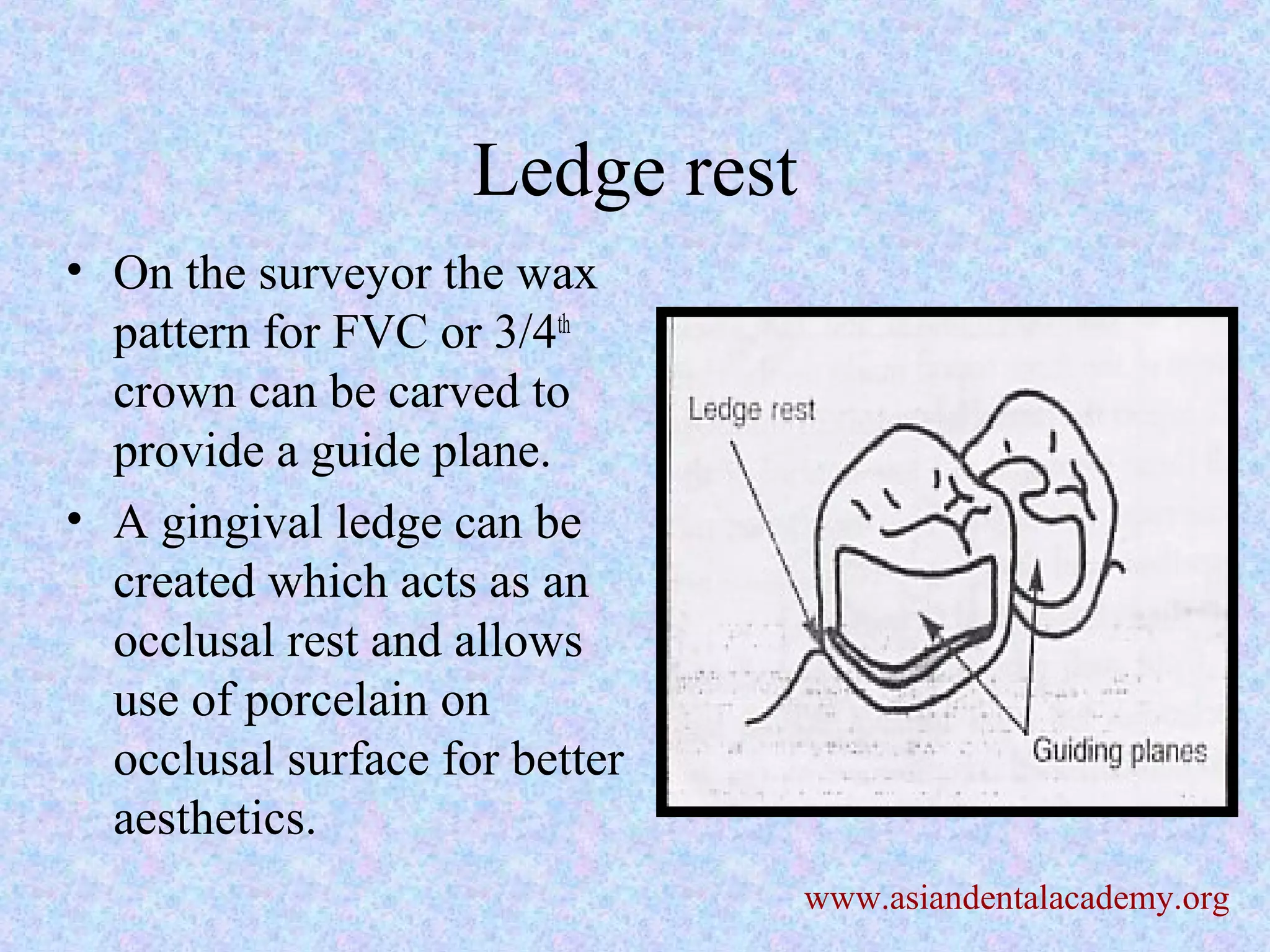 Rests & Rest seats in removable partial Dentures | PPT